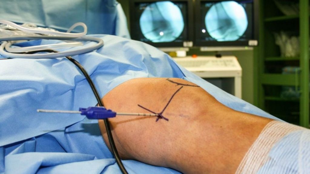 El Clínico San Carlos de Madrid realiza los primeros implantes de ...