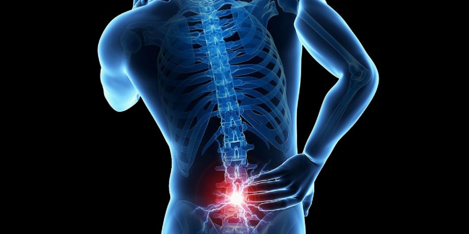 Qué es el lumbago, cómo se manifiesta y cómo mejorar