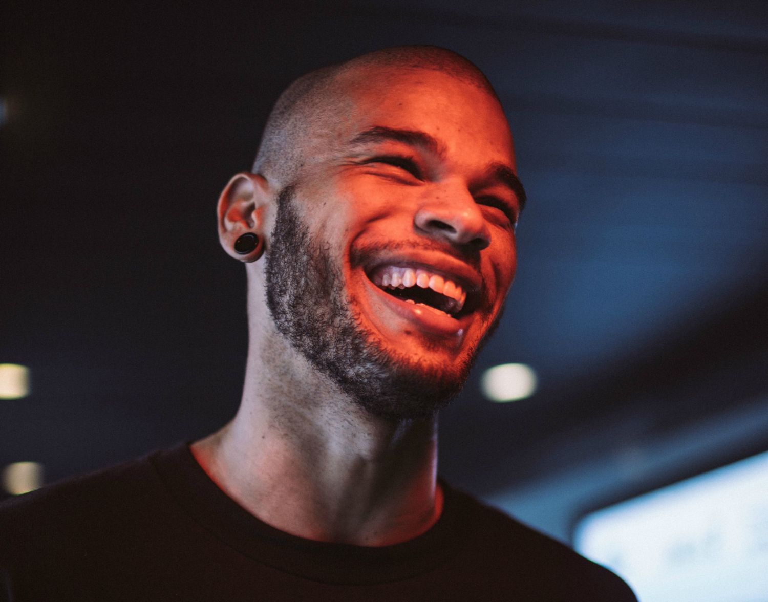 Ventajas de ser calvo: por todo esto has de olvidar hacerte un injerto