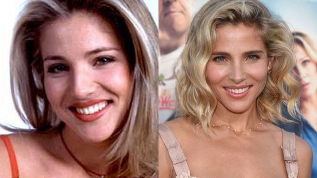 Elsa Pataky As Era Su Rostro Antes De Someterse A mil Operaciones