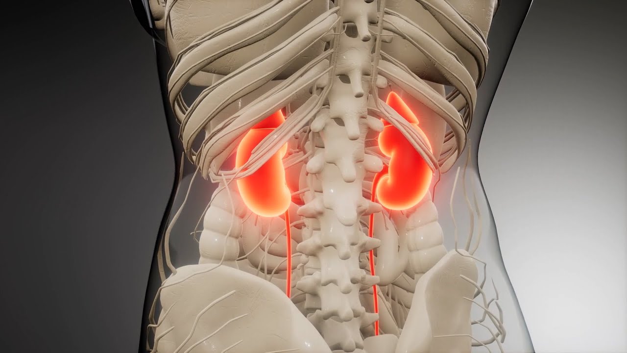 ¿Qué es un cólico nefrítico?