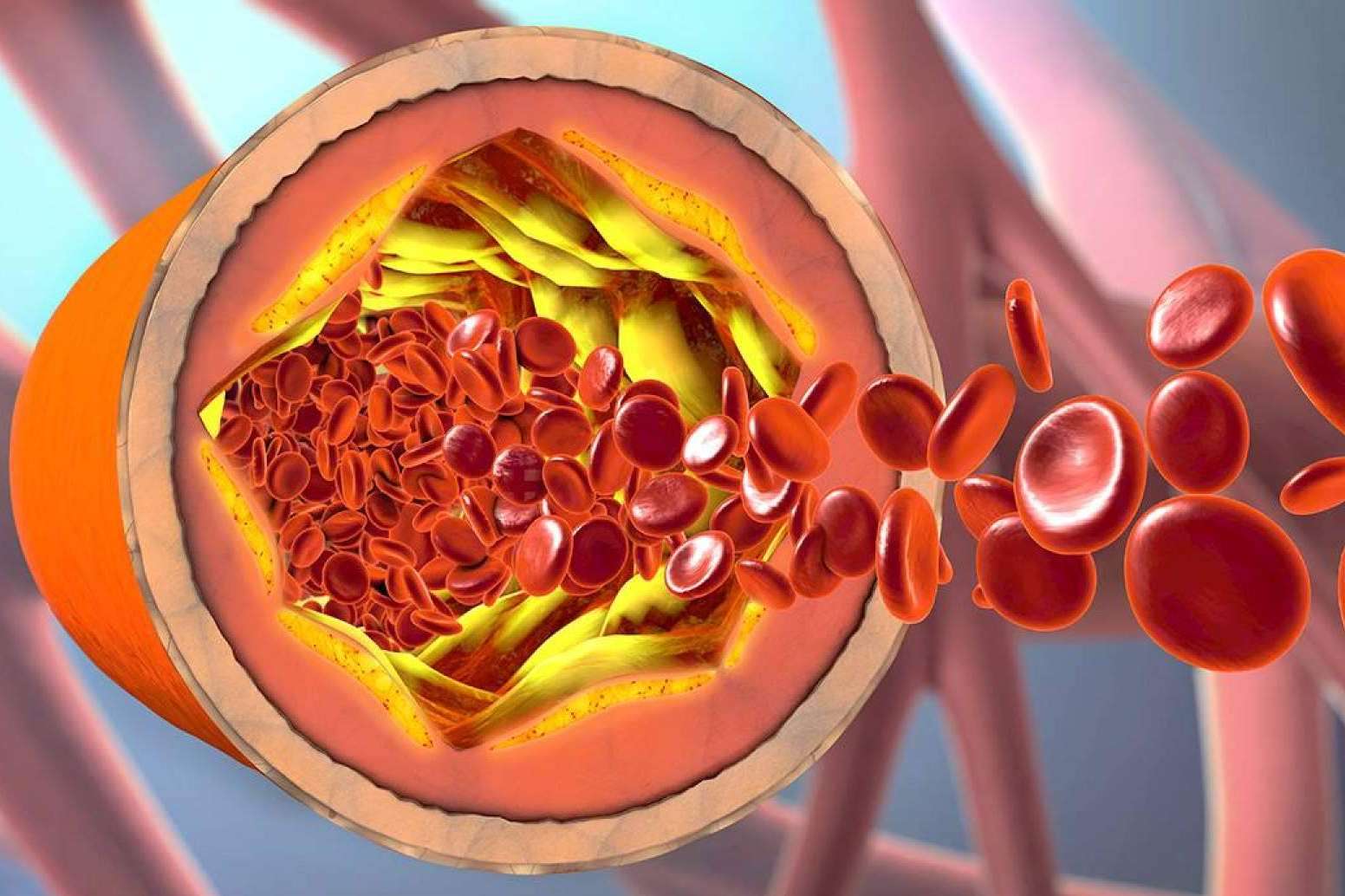 ReduCol 25, la fórmula innovadora con levadura roja de arroz rojo de ...